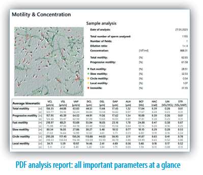 AndroScope®, For Mobile Semen Analysis Kit, Each – Agtech Inc